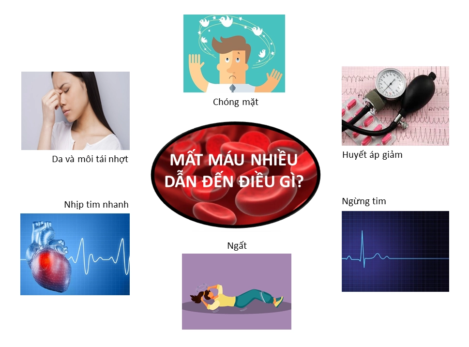 Thông tin MẤT MÁU NHIỀU DẪN ĐẾN ĐIỀU GÌ? giúp bạn yên tâm về sức khỏe.